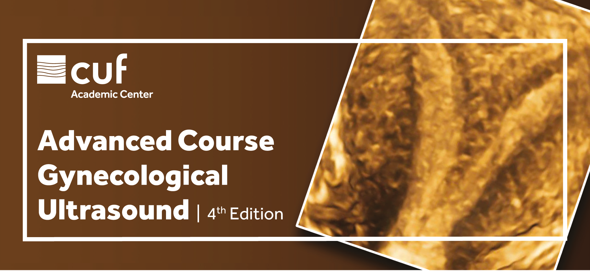 Advanced Course Gynecological Ultrasound - SPG